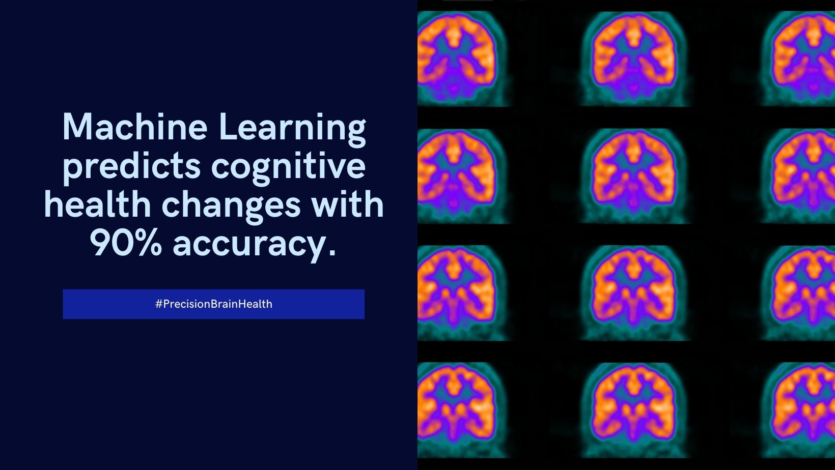 UT Dallas Researchers Use Machine Learning to Predict Cognitive Health ...
