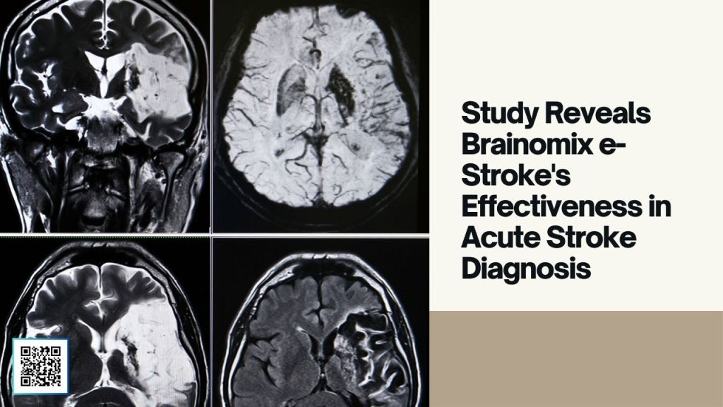 Brainomix e-Stroke 's Effectiveness in Acute Stroke Diagnosis