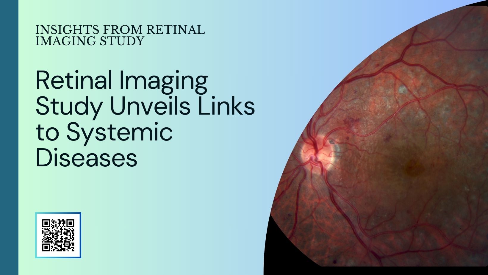Retinal Imaging Study Unveils Links to Systemic Diseases - Medical News ...
