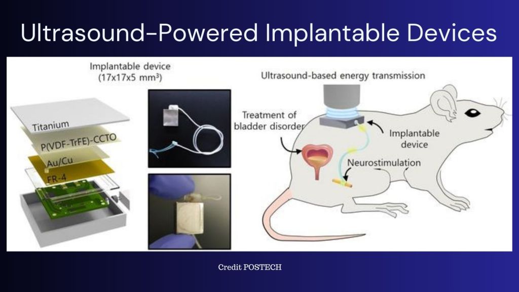 Ultrasound-Powered Implantable Devices - Medical News Observer