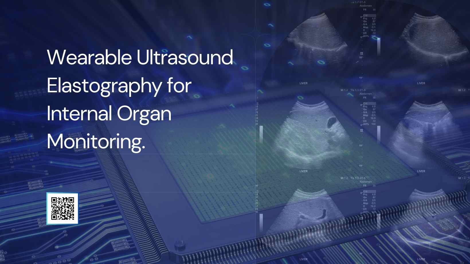 Wearable Ultrasound Elastography for Continuous Organ Monitoring ...