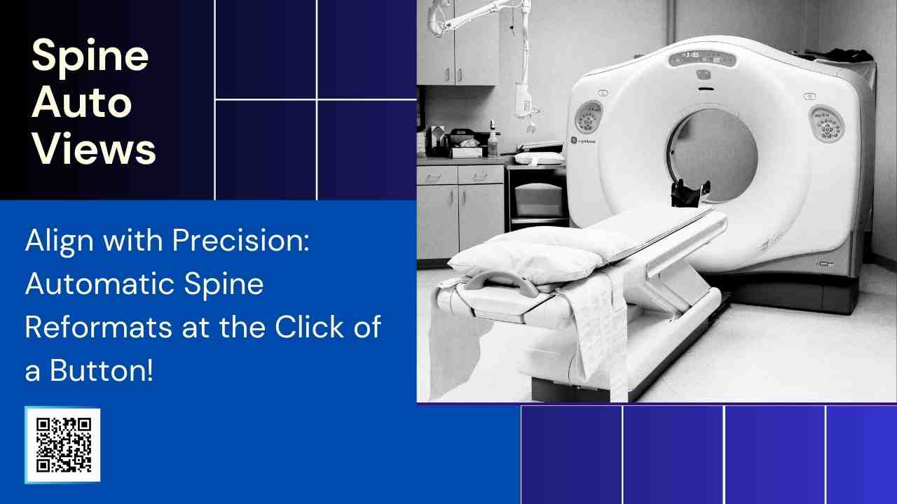 Spine Auto Views - Medical News Observer